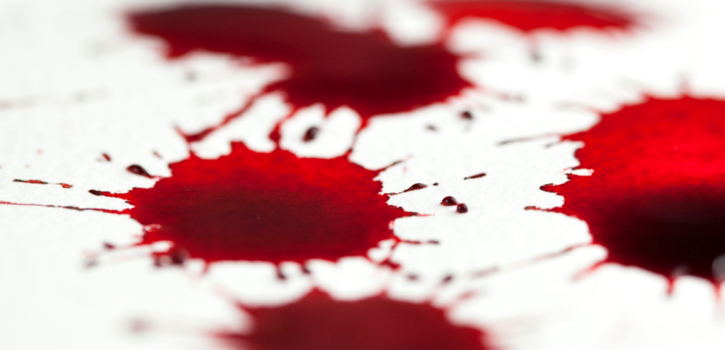 Blood-Stain Resistant Upholstery Fabric in Healthcare